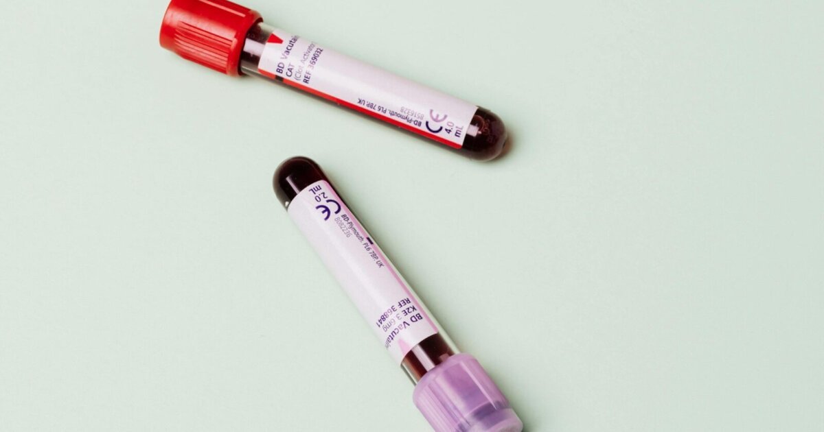 Urée : nouvelles conditions de réalisation - Bioxa